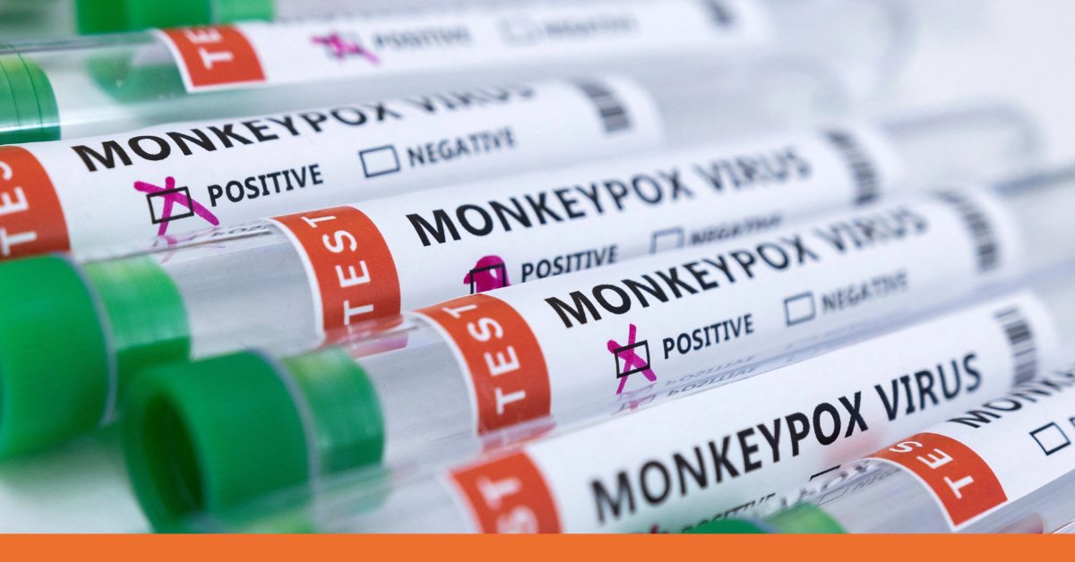 monkeyfox (3) - docsurgentcare