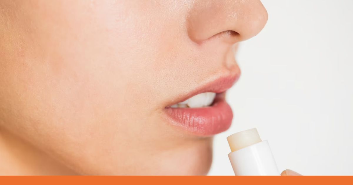 The Ultimate Guide to Cold Sores: Causes, Treatment, and Prevention