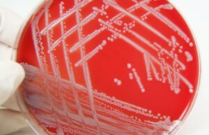 7 Signs of Staph Infection and When to Seek Urgent Care in Bridgeport, CT