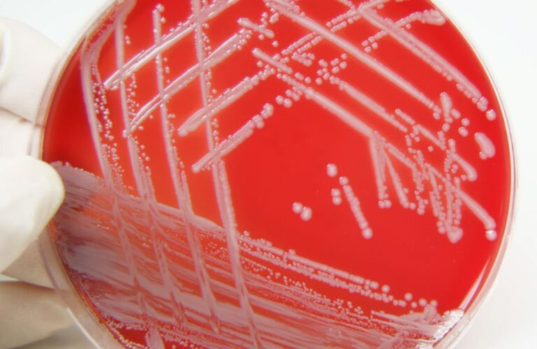 7 Signs of Staph Infection and When to Seek Urgent Care in Bridgeport, CT