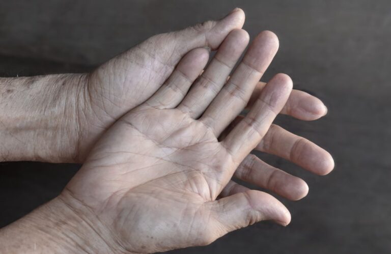 What Causes Paleness and When to Call a Primary Care Doctor in ...