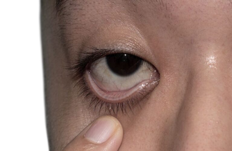 What Causes Paleness and When to Call a Primary Care Doctor in ...