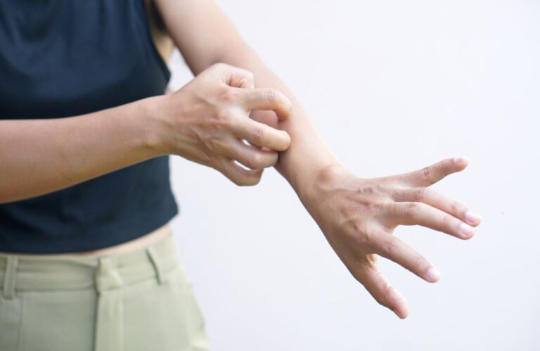 10 Effective Home Remedies for Heat Rashes: When to Seek Help from ...